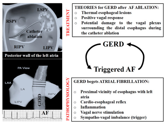 Gastro-Esophageal Reflux Disease and Paroxysmal Atrial Fibrillation ...