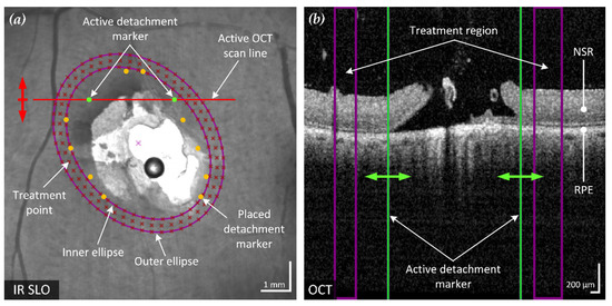 Life | Free Full-Text | High-Precision Optical Coherence Tomography ...