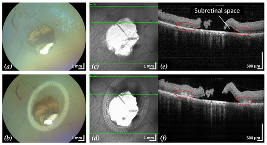 Life | Free Full-Text | High-Precision Optical Coherence Tomography ...