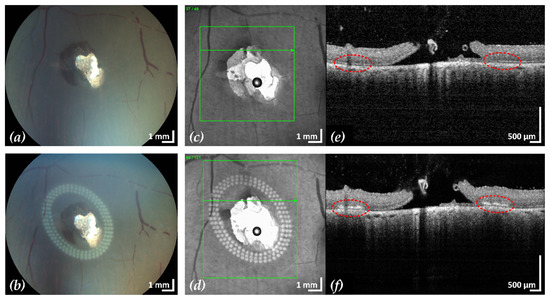 Life | Free Full-Text | High-Precision Optical Coherence Tomography ...