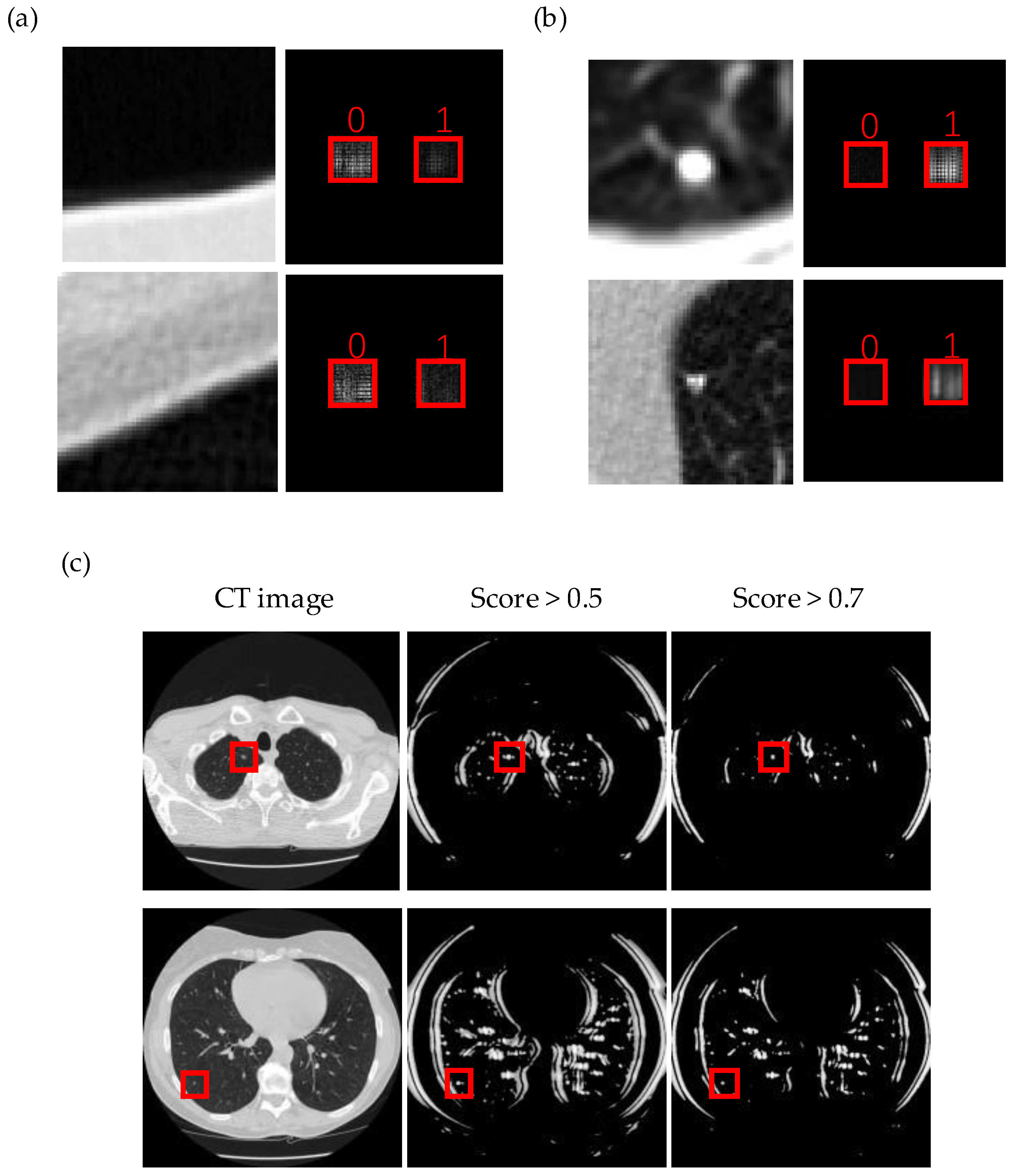 Life Free Full Text Pulmonary Nodule Detection And Classification