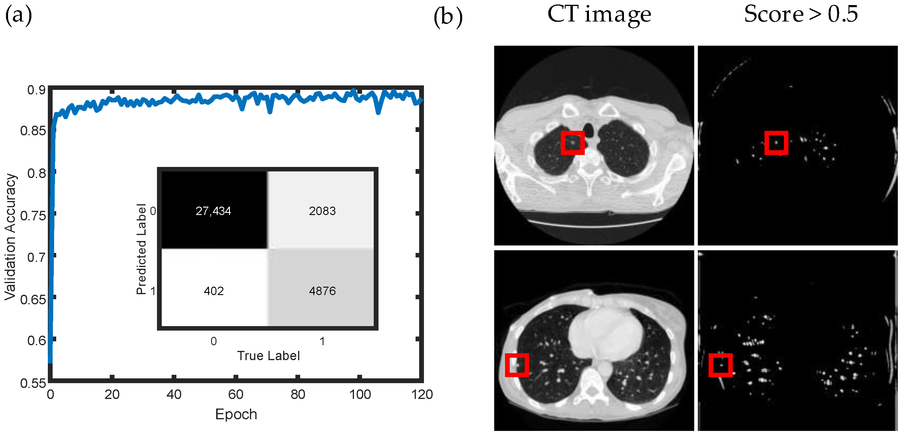 Pulmonary Nodule Detection and Classification Using All-Optical Deep Diffractive Neural Network