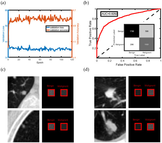 Pulmonary Nodule Detection and Classification Using All-Optical Deep ...