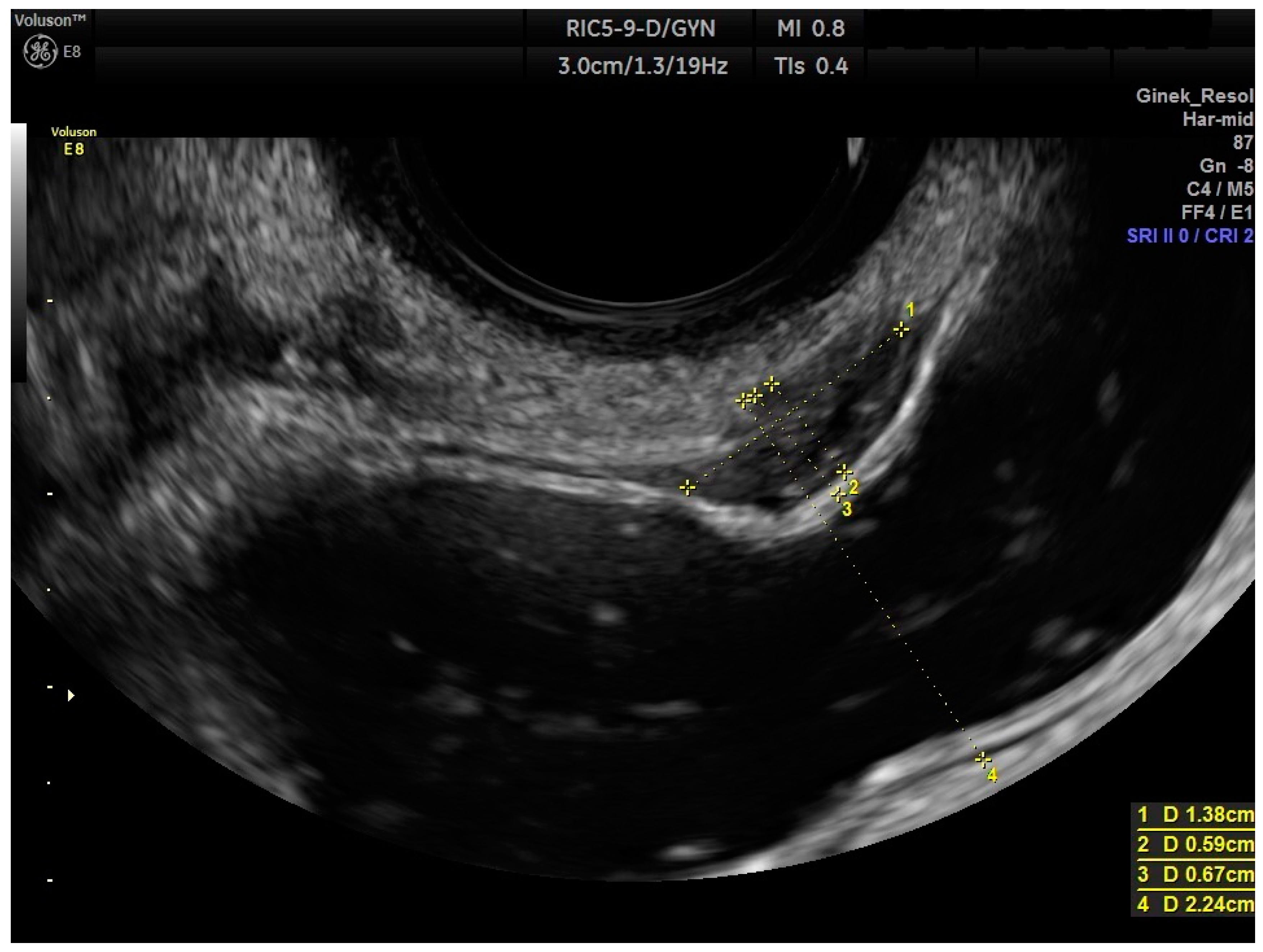 Life Free Full Text The Utility Of Rectal Water Contrast