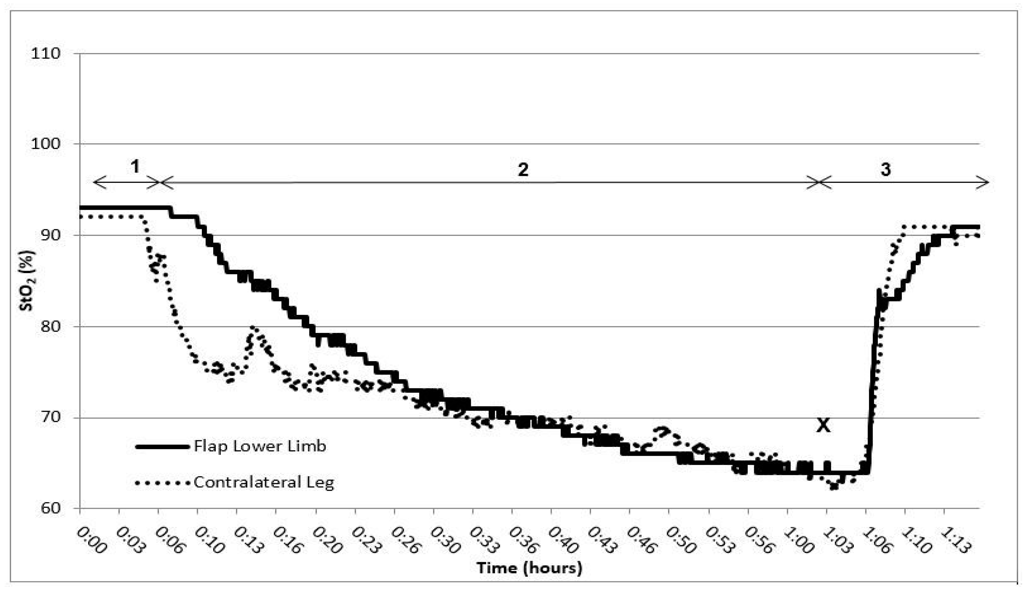 Tissue Oximetry Changes during Postoperative Dangling in Lower ...