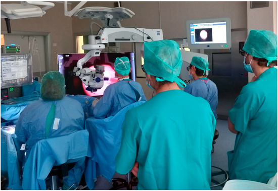 Three-Dimensional Visualization System for Vitreoretinal Surgery ...