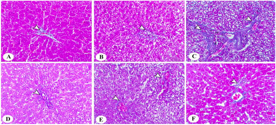 The Development of Nonalcoholic Fatty Liver Disease and Metabolic ...