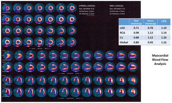 Life | Free Full-Text | Cardiac Imaging in Women with Ischemic Heart ...