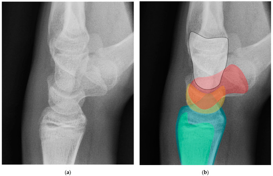 Life | Free Full-Text | Imaging Diagnosis and Management of Carpal ...