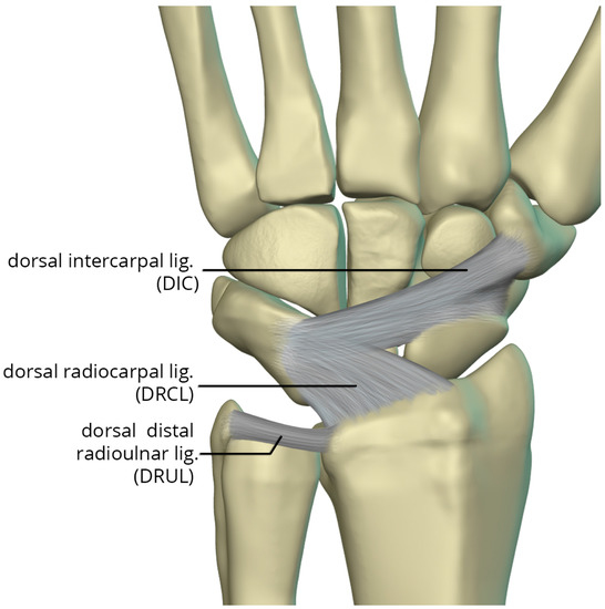 Life | Free Full-Text | Imaging Diagnosis and Management of Carpal ...
