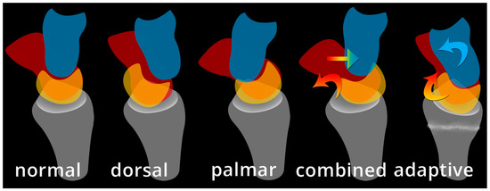 Life | Free Full-Text | Imaging Diagnosis and Management of Carpal ...
