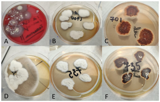 Fusarium spp. in Human Disease: Exploring the Boundaries between ...