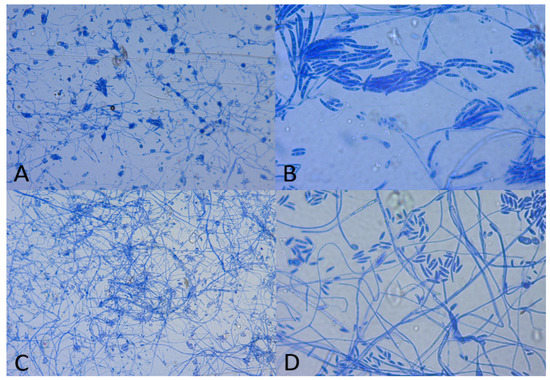 Fusarium spp. in Human Disease: Exploring the Boundaries between ...