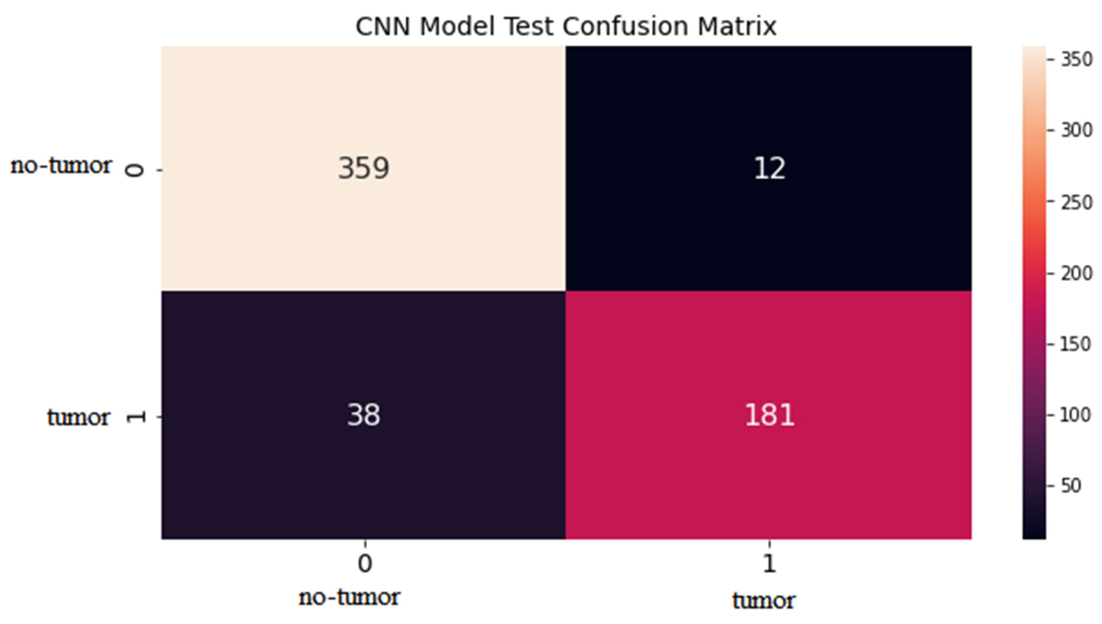 Brain Tumor Detection And Classification Using Fine Tuned Cnn With Resnet50 And U Net Model A