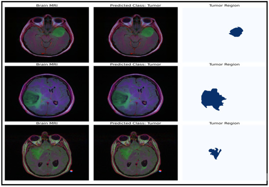 Brain Tumor Detection and Classification Using Fine-Tuned CNN with ResNet50 and U-Net Model: A ...