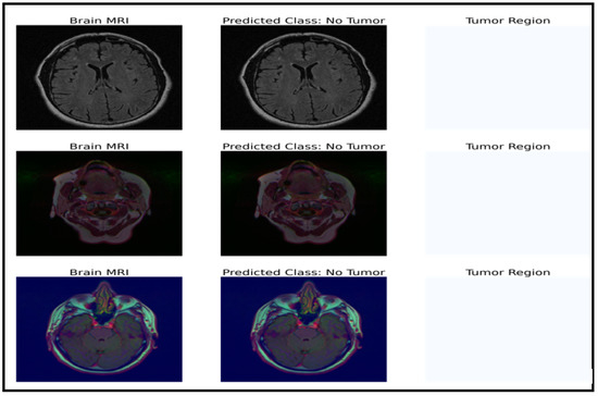 Brain Tumor Detection and Classification Using Fine-Tuned CNN with ...