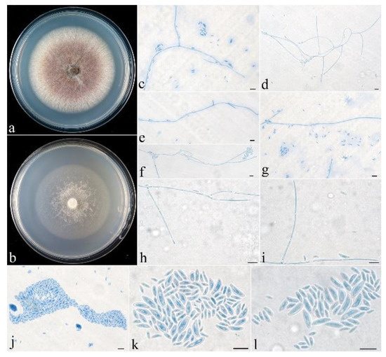 New Species of Neocosmospora (Ascomycota) from China as Evidenced by ...