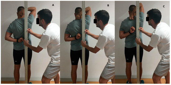 Pilot Study: The Relationship between Foot Posture and Movement Quality ...