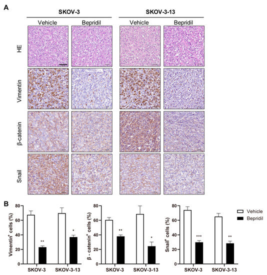 Suppression of Metastatic Ovarian Cancer Cells by Bepridil, a Calcium ...