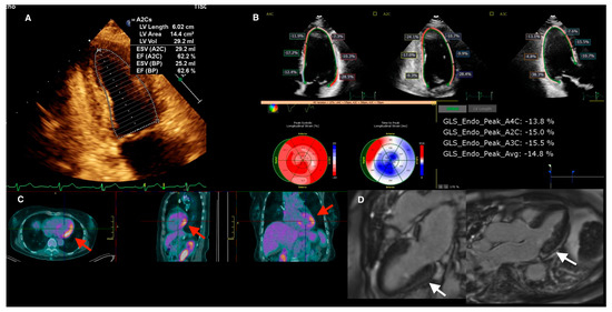 The Role of Echocardiography in the Contemporary Diagnosis and ...