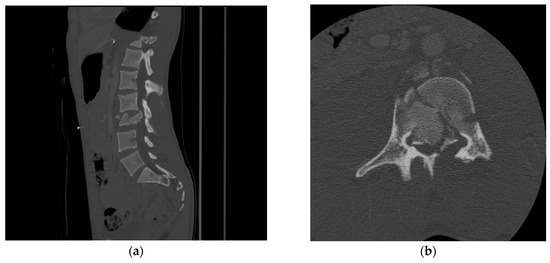 The Role of Magnetic Resonance Imaging and Computed Tomography in ...
