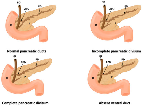 Pancreatic Duct