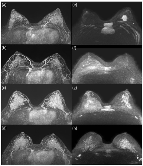 Life | Free Full-Text | The Role of Diffusion-Weighted Imaging Based on ...