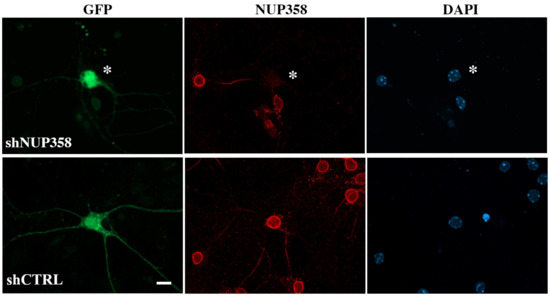 Nucleoporin Nup358 Downregulation Tunes the Neuronal Excitability in ...
