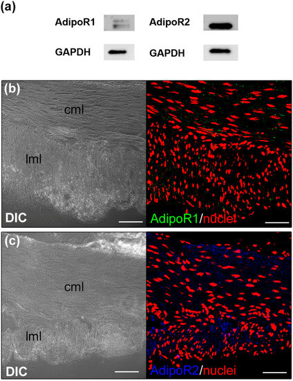 Adiponectin Modulates Smooth Muscle Cell Morpho-Functional Properties ...