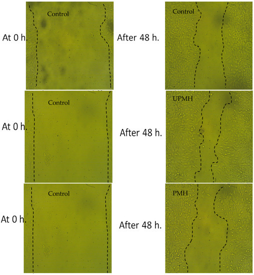 Anti-Yeasts, Antioxidant and Healing Properties of Henna Pre-Treated by ...