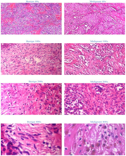 Life | Free Full-Text | Improved Breast Cancer Classification through ...