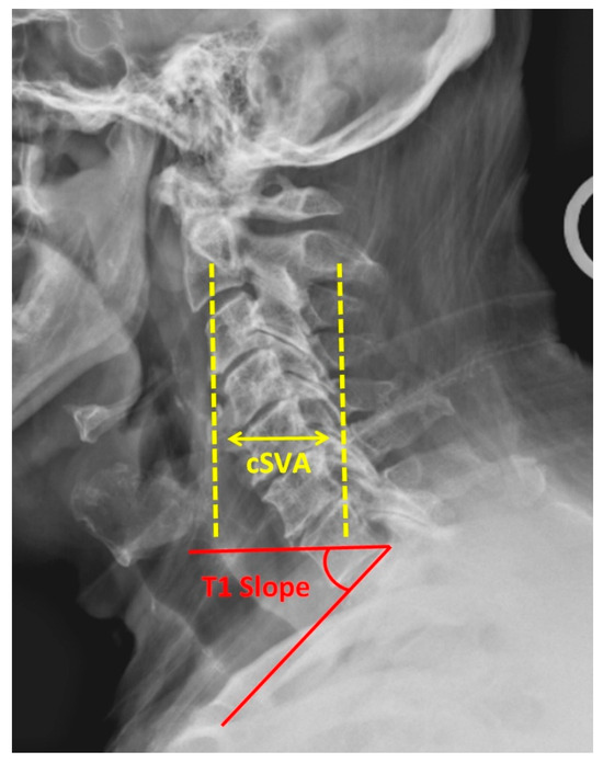 Emerging Technologies within Spine Surgery