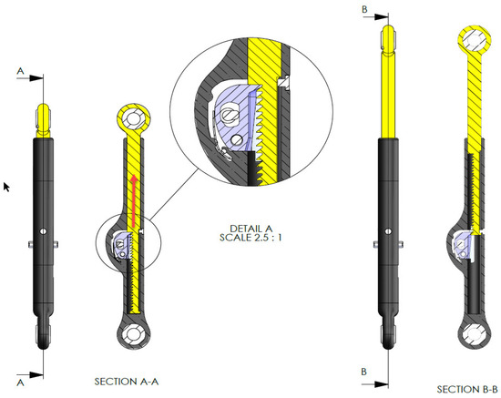 Surgical Treatment of Adolescent Idiopathic Scoliosis with the ApiFix ...