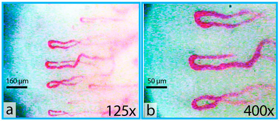Life | Free Full-Text | Correlation between the Capillary Blood Flow ...