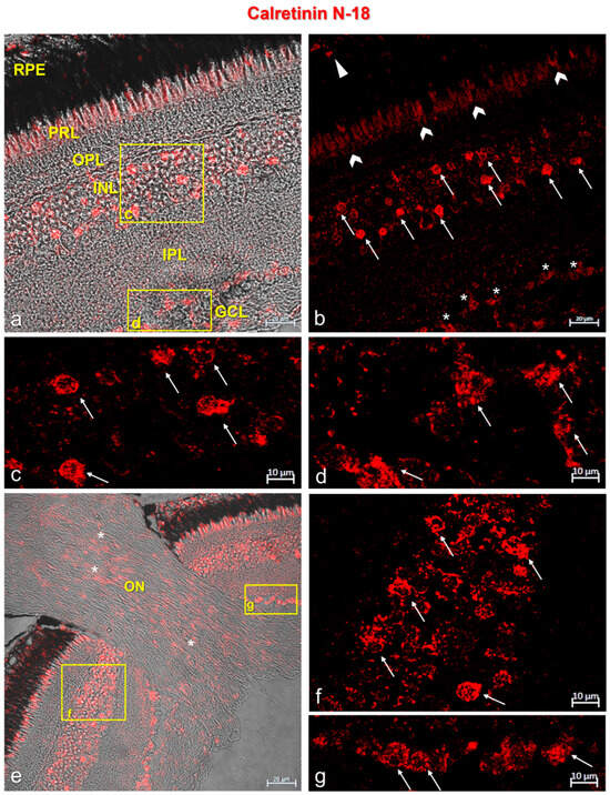 Localization of Calretinin, Parvalbumin, and S100 Protein in ...