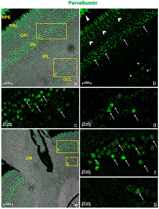 Localization of Calretinin, Parvalbumin, and S100 Protein in ...