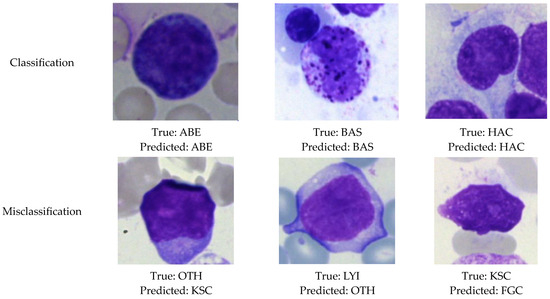 Life | Free Full-Text | An Intelligent Attention-Based Transfer Learning Model for Accurate ...
