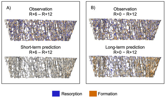 Predicting Bone Adaptation in Astronauts during and after Spaceflight