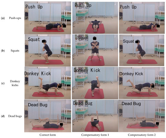 Effect of Video Camera Angle on the Detection of Compensatory Movements ...