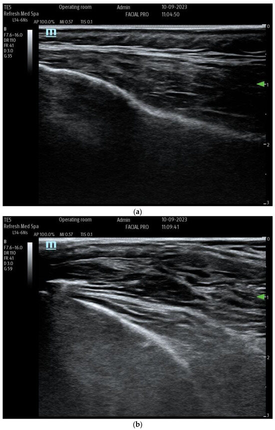 Clinical Implications of the Fascial System: A Commentary on One ...
