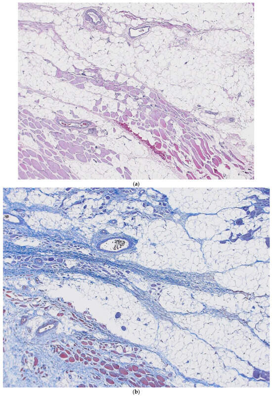 Clinical Implications of the Fascial System: A Commentary on One ...