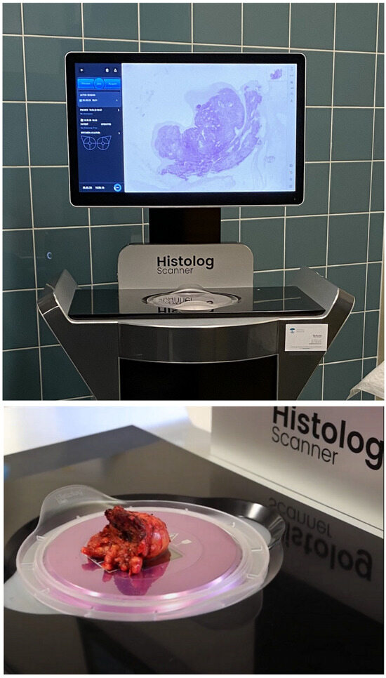 SENOSI Confocal Microscopy: A New and Innovating Way to Detect Positive ...
