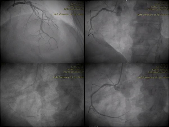 What to Do When There Is Something Unexpected?