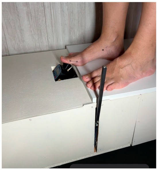 Biomechanical Effect on Jack’s Test on Barefoot Position, Regular Socks ...