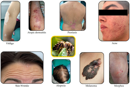 Natural Sources of Therapeutic Agents Used in Skin Conditions