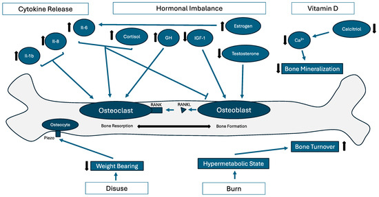 Navigating Post-Traumatic Osteoporosis: A Comprehensive Review of ...
