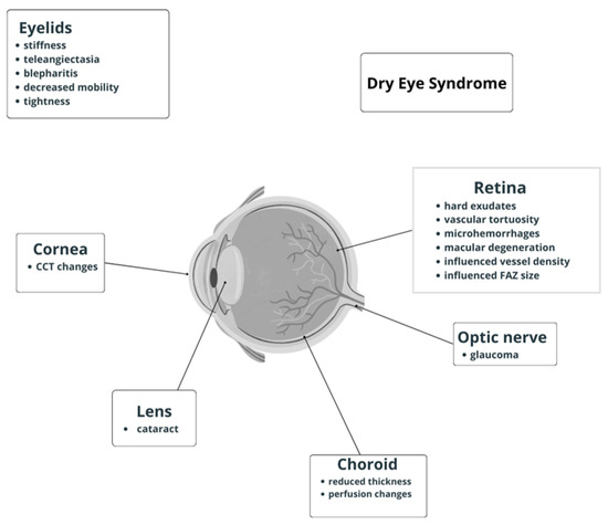 Life | Free Full-Text | Ocular Manifestation in Systemic Sclerosis—A ...