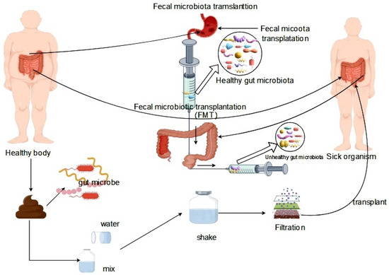 Mechanisms of Male Reproductive Sterility Triggered by Dysbiosis of ...