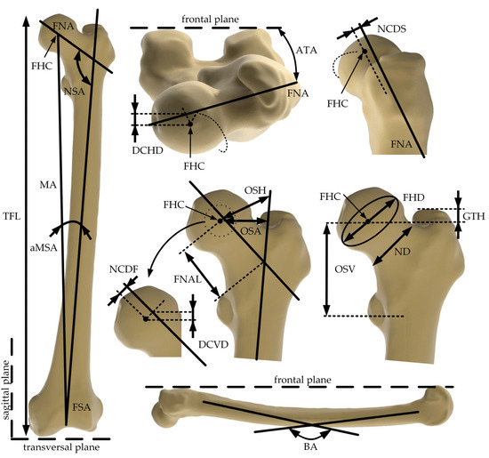 The Morphology of the Femur Influences the Fracture Risk during ...