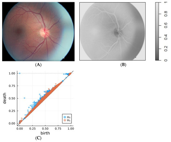 Determinants of Human Asymmetry: Does Asymmetrical Retinal Vasculature ...